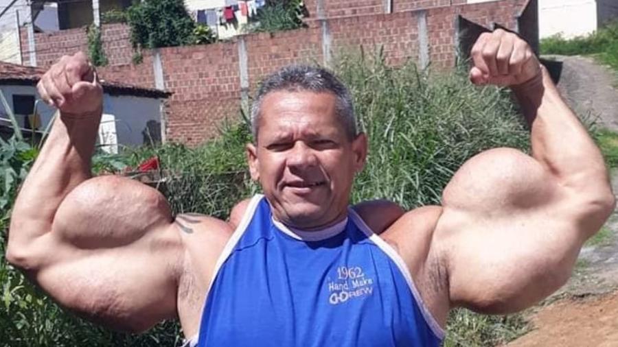 Murió “Popeye”, el fisicoculturista brasileño que se inyectaba aceite ...